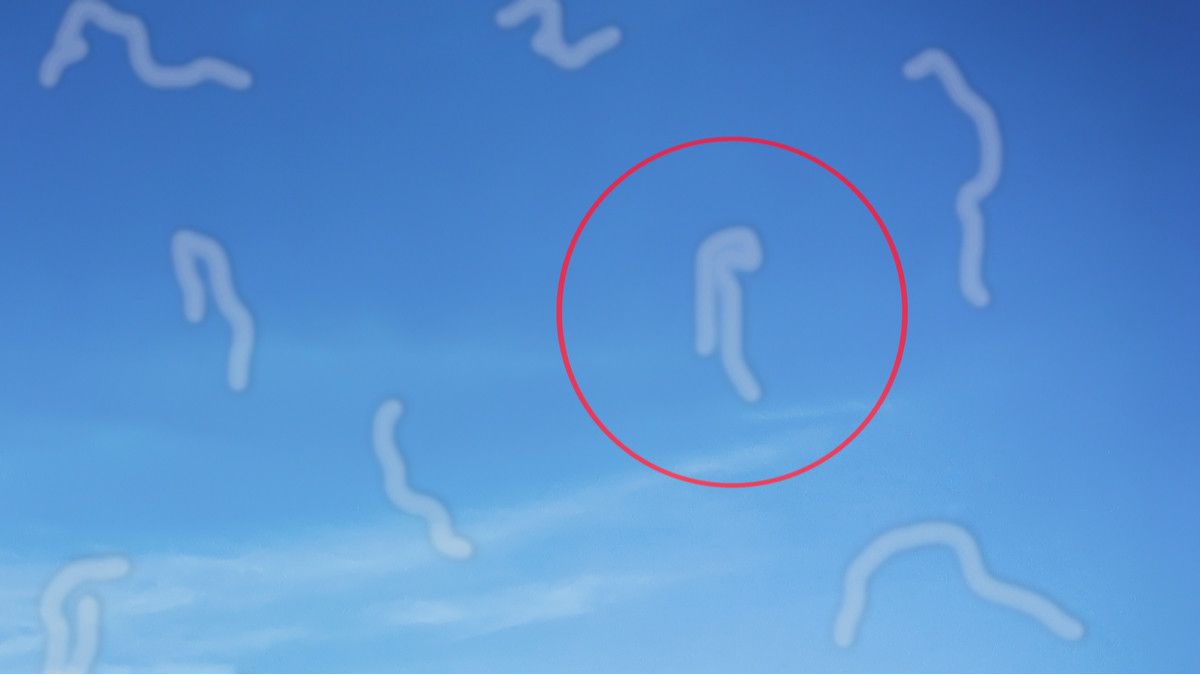 Melihat Bintik-Bintik Melayang? Ini Penyebab Floater di Mata - KlikDokter