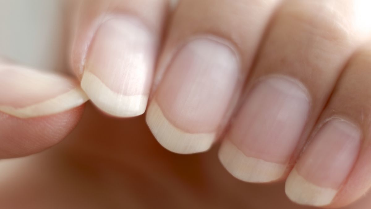 Penyakit Penyebab Kuku Tangan Pucat, Apa Saja? - KlikDokter