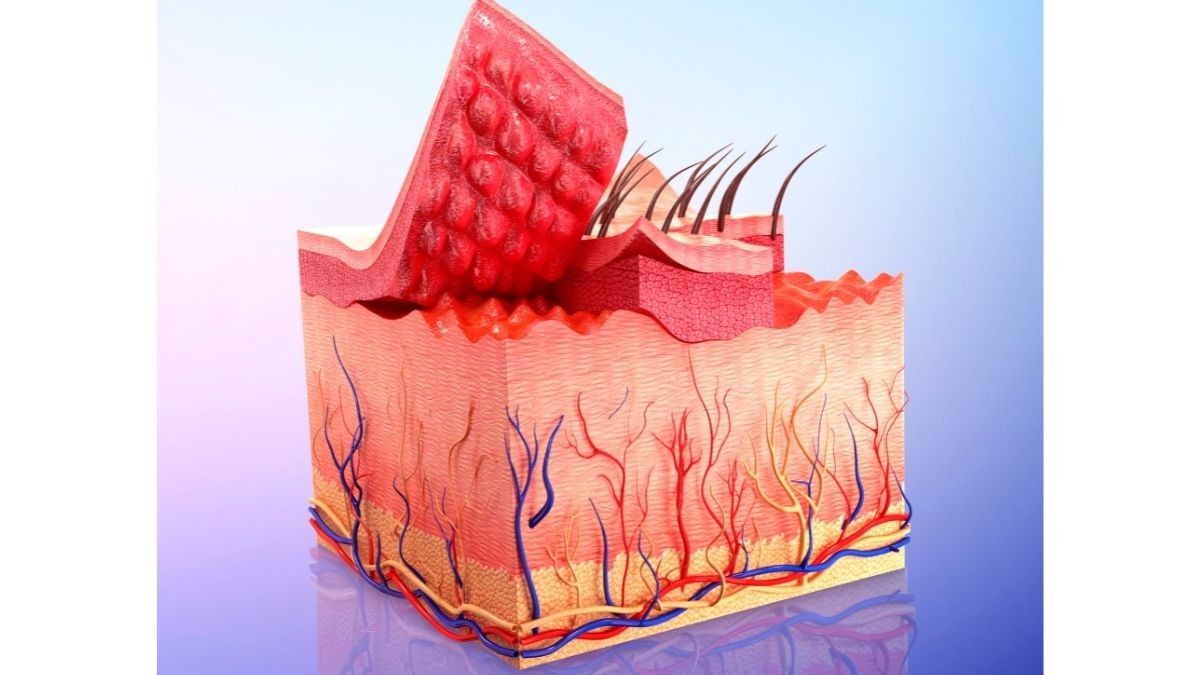 Mengenal Lapisan Pelindung Kulit pada Epidermis - KlikDokter