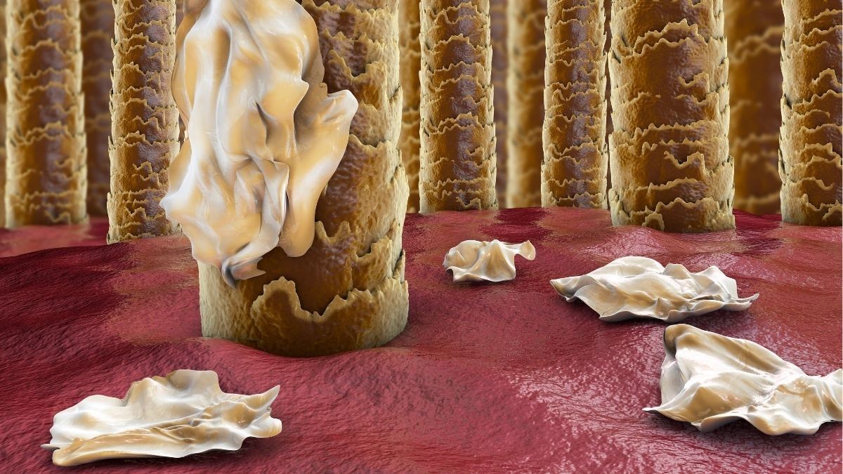 Pityriasis Alba, Bintik Putih Kulit yang Mirip Panu - KlikDokter