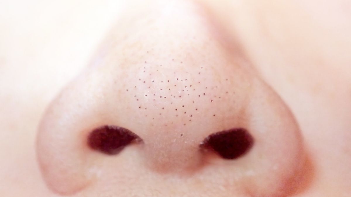 4 Kondisi Medis Sebabkan Upil Menumpuk - KlikDokter