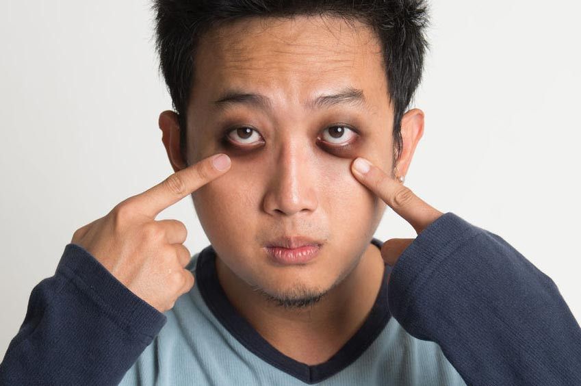 Menghilangkan Mata Panda dengan Mudah - KlikDokter