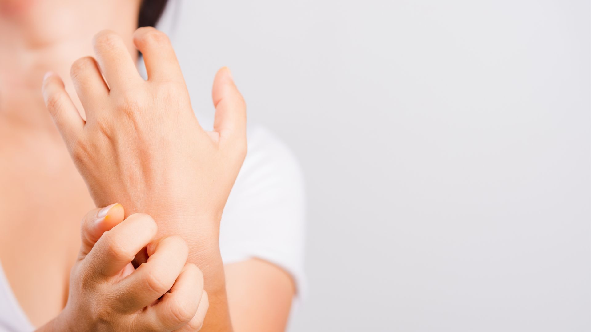 Ini 6 Ciri-Ciri Kurap yang Perlu Kamu Ketahui - KlikDokter