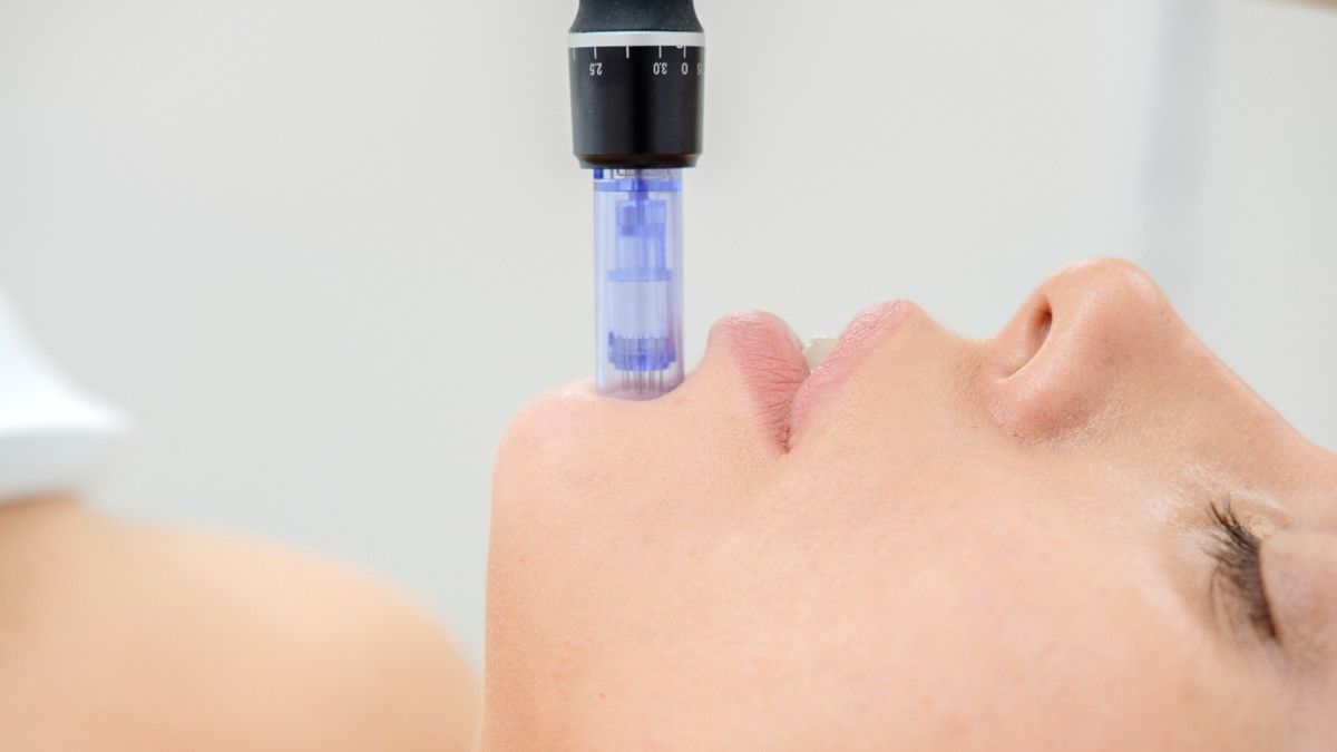 Mengenal Microneedling, Perawatan Wajah dengan Tusuk Jarum - KlikDokter