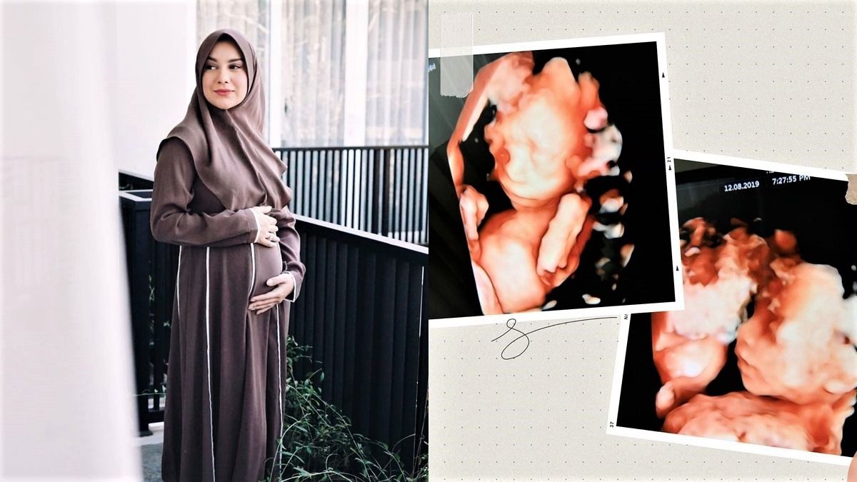 Sebelum Bayinya Meninggal, Ini 5 Masalah Kesehatan Irish Bella saat Hamil - KlikDokter