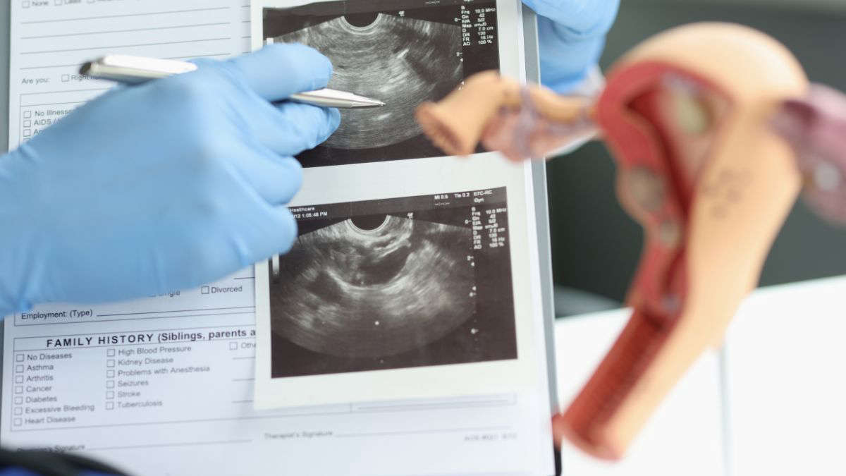 Cara Menjaga Tensi Normal Ibu Hamil Demi Kesehatan Mama dan Janin ...
