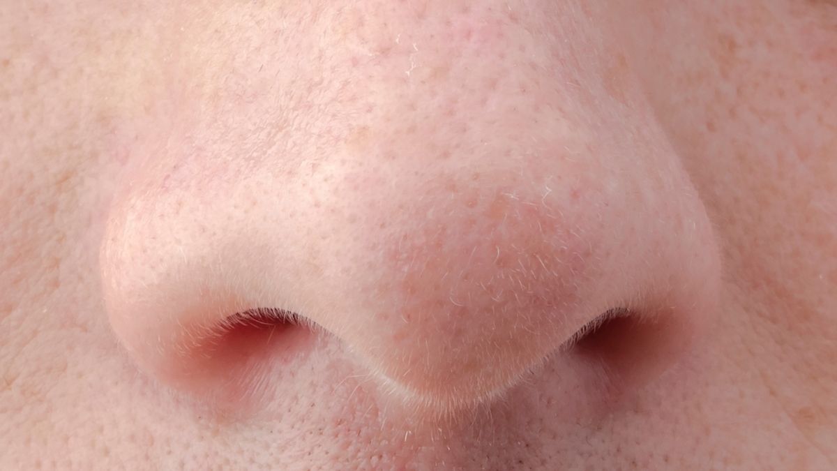 Yuk, Kenali Anatomi Hidung Manusia! - KlikDokter