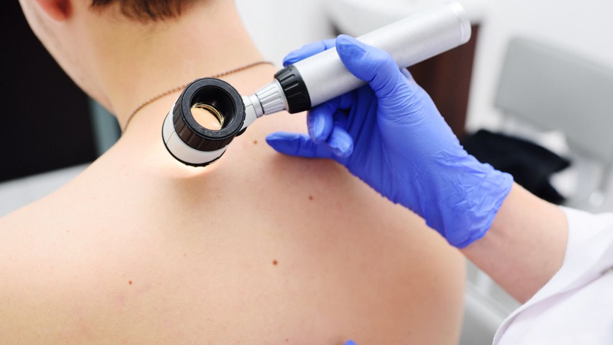 Penyakit yang Ditangani Dokter Spesialis Kulit dan Kelamin - KlikDokter