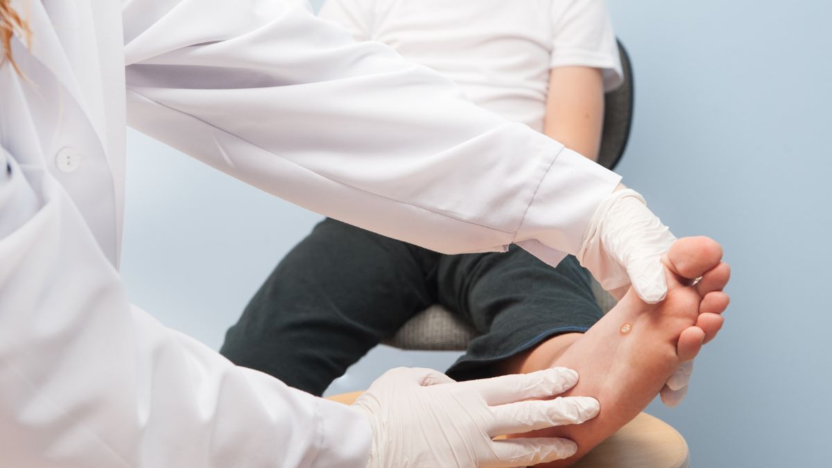 5 Ciri-Ciri Kutil di Kulit yang Perlu Diketahui - KlikDokter