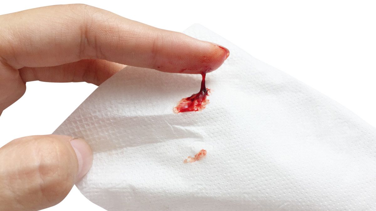 Kenali 6 Penyebab Ingus Berdarah dan Cara Mengatasinya - KlikDokter