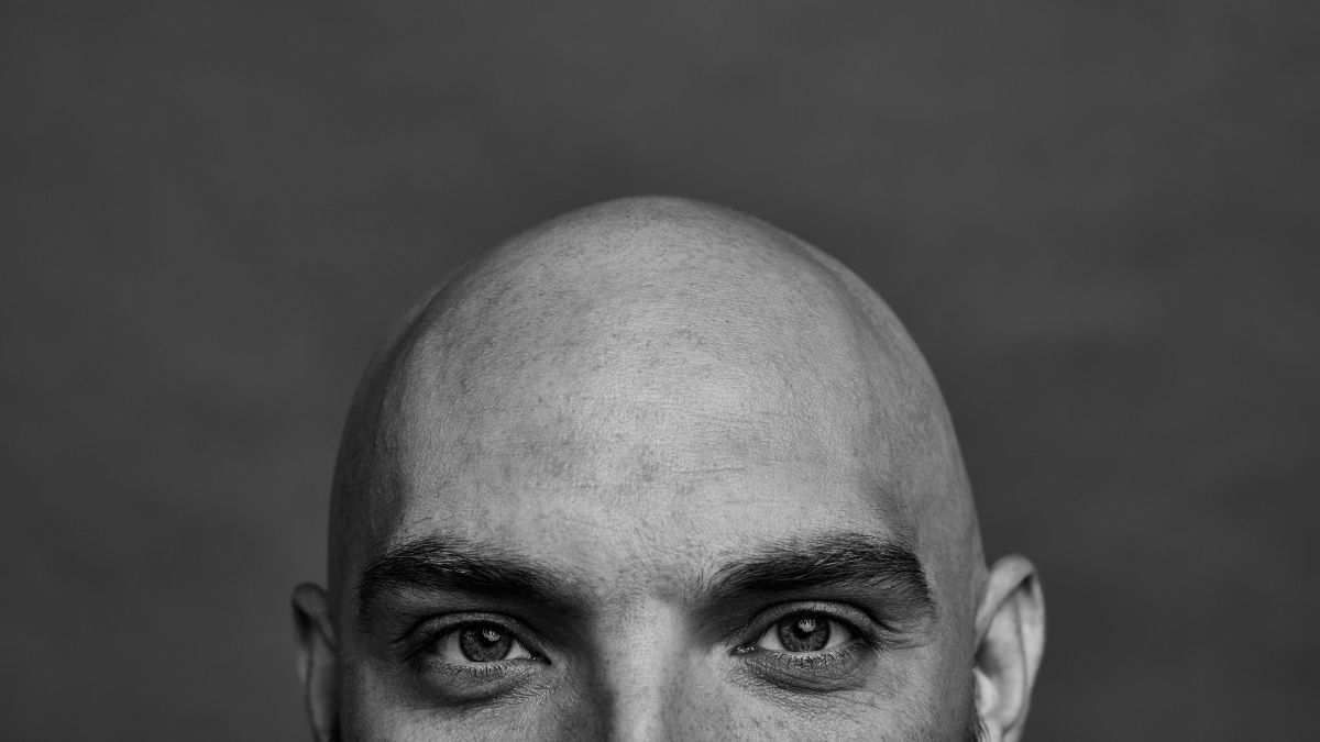 Alasan Orang dengan Kepala Botak Perlu Keramas - KlikDokter