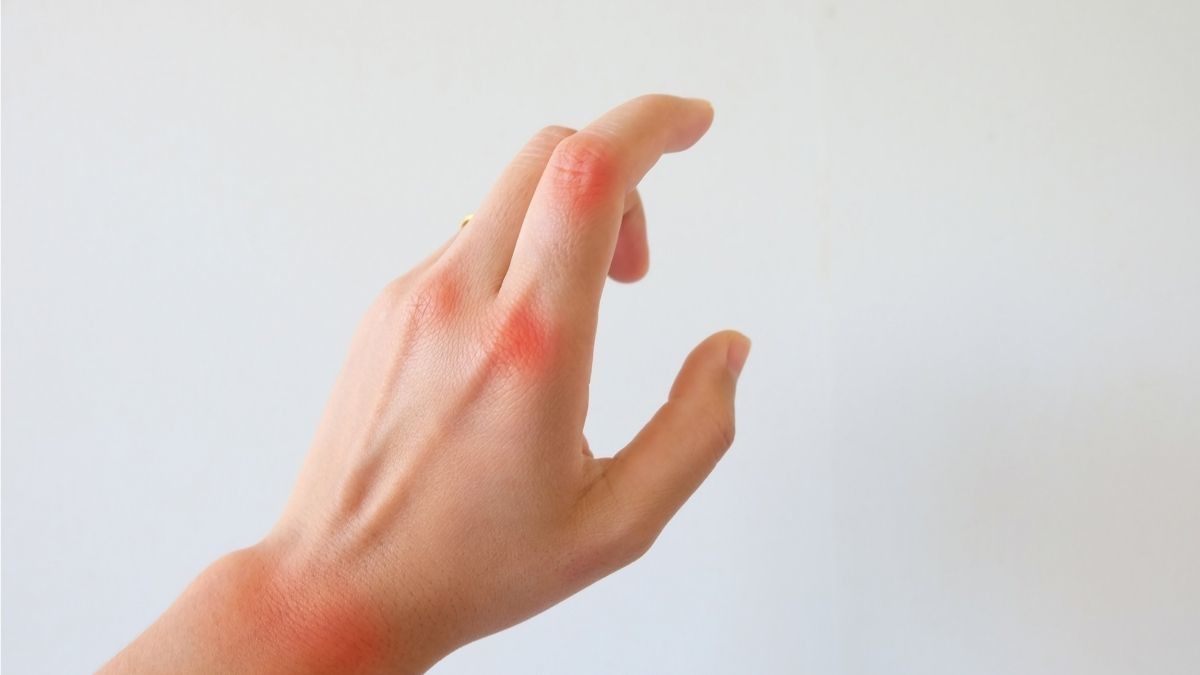 Natrium Diklofenak - Manfaat, Dosis, dan Efek Samping - KlikDokter