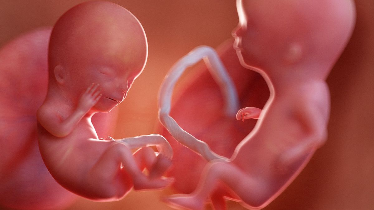 Twin-to-Twin Transfusion Syndrome (TTTS), Sindrom Apa Ini? - KlikDokter