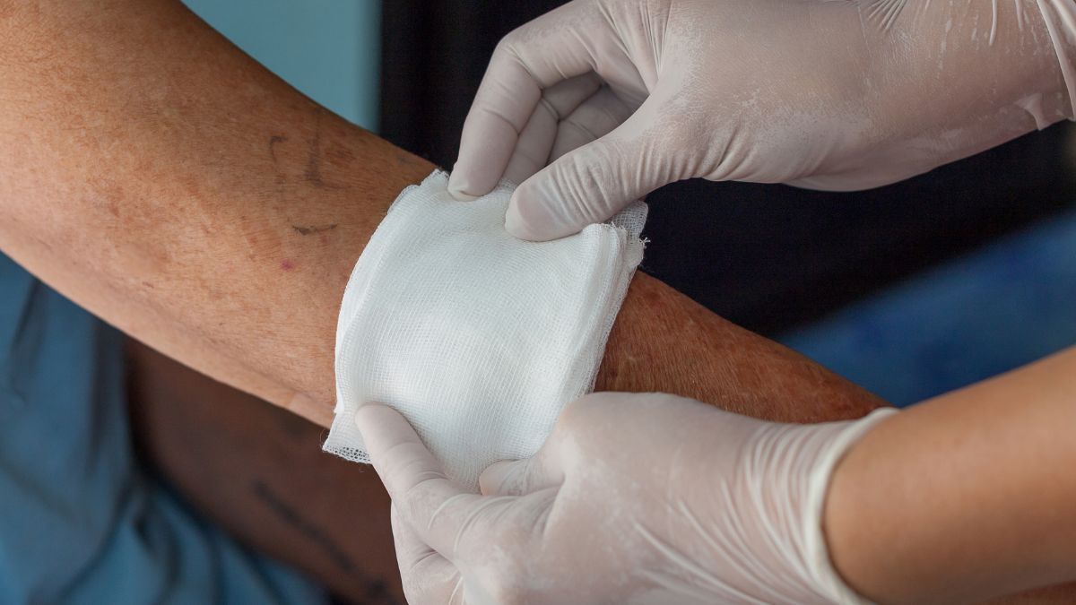 9 Perawatan Luka Diabetes untuk Cegah Komplikasi - KlikDokter