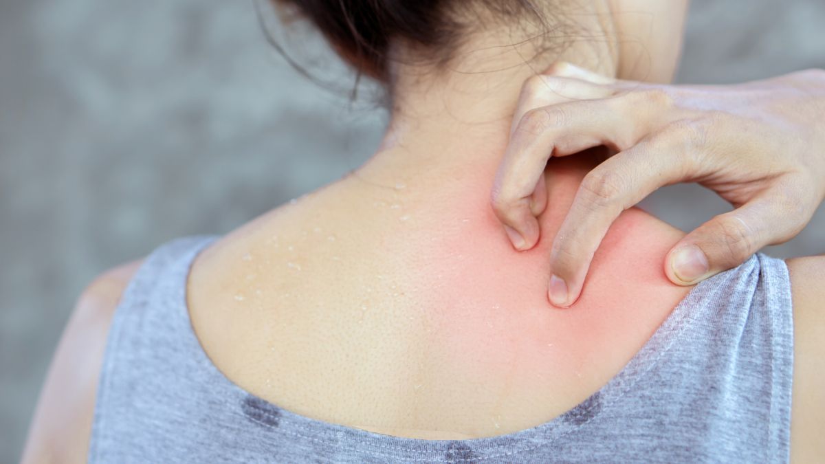 Bukan Memperbesar Payudara, Ini 5 Manfaat Minyak Bulus - KlikDokter