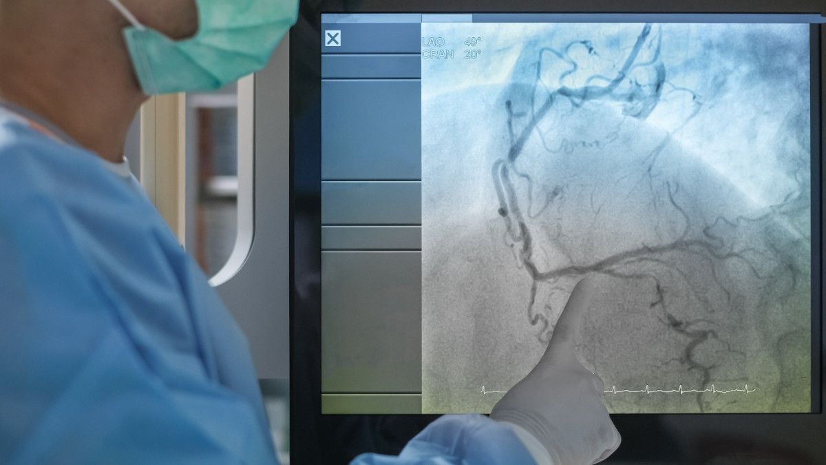 7 Jenis Skrining dan Pemeriksaan Jantung yang Mesti Kamu Tahu - KlikDokter