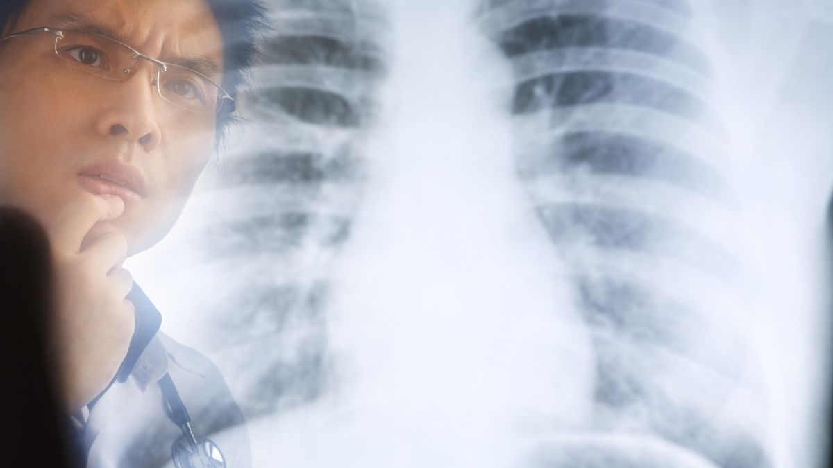 Pemeriksaan X-ray Kenali Tujuan Hingga Prosedurnya - KlikDokter