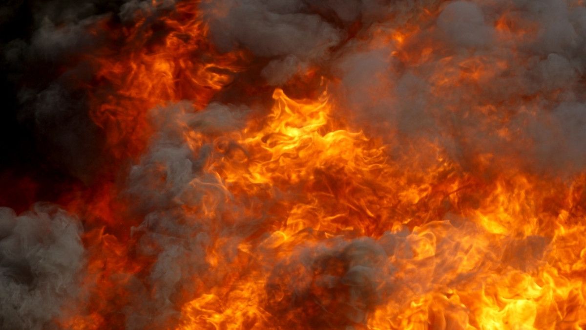 Mengapa Luka Bakar Sebabkan Gangguan Pernapasan? - KlikDokter