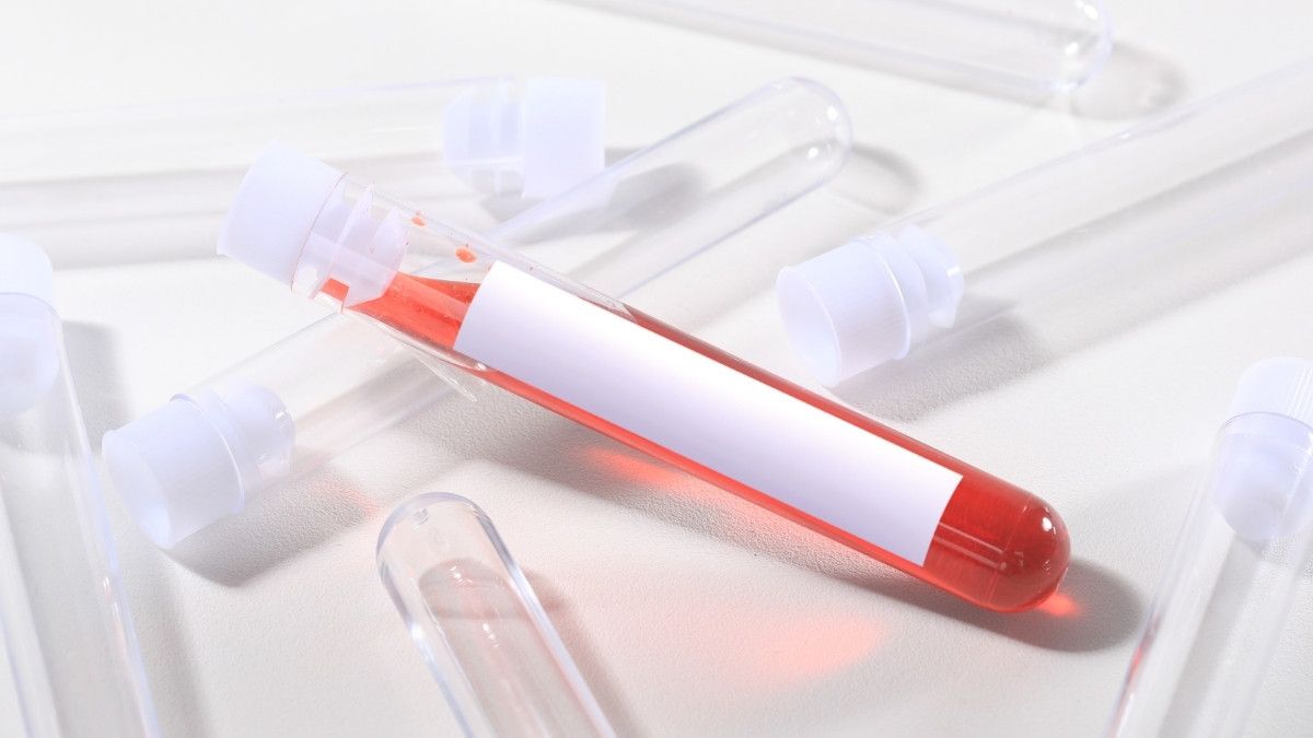 Mengenal Albumin, Kadar Normal dan Fungsinya - KlikDokter