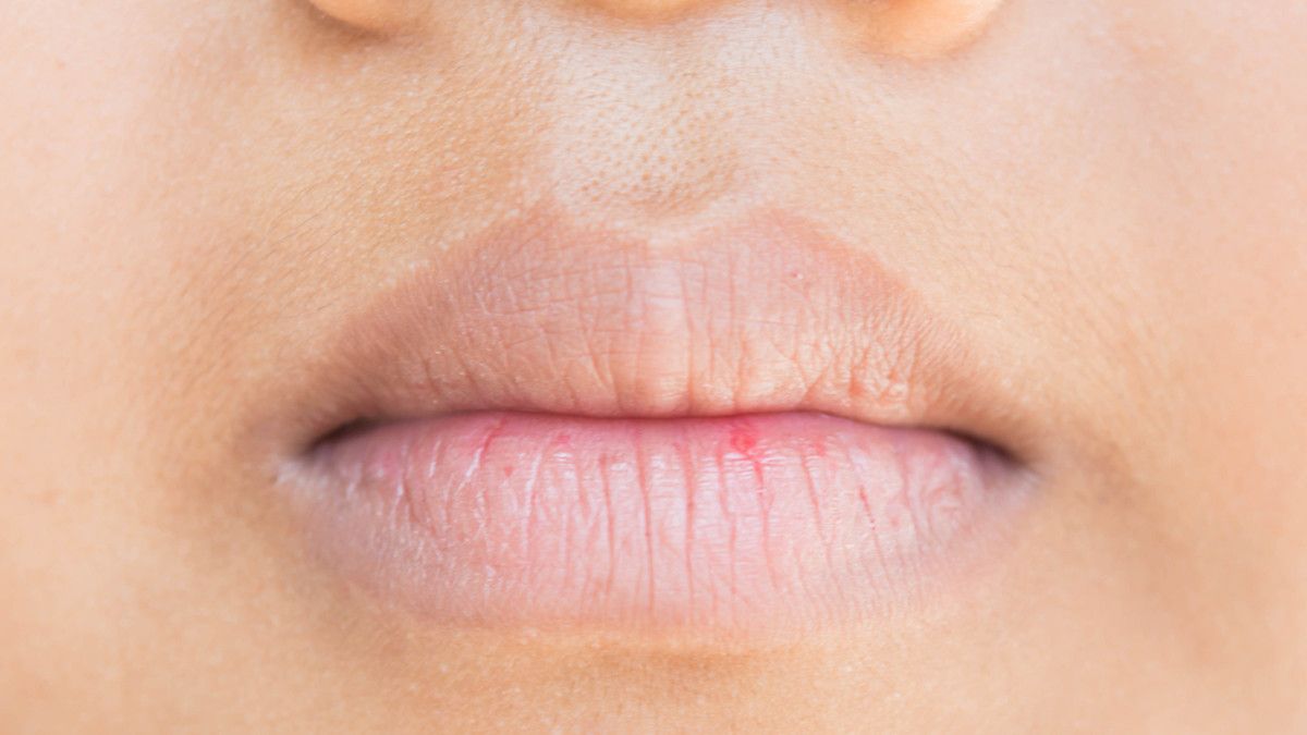Jangan Menjilat Bibir Kering, Ini Alasannya - KlikDokter