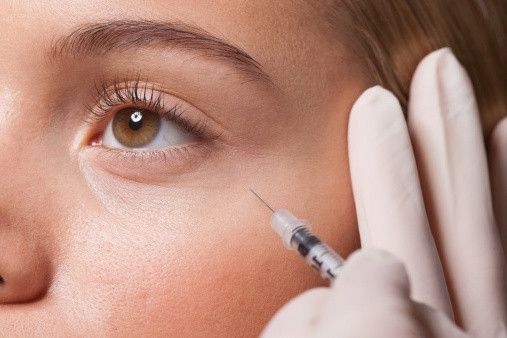 Semua yang Perlu Anda Tahu tentang Suntik Botox - KlikDokter