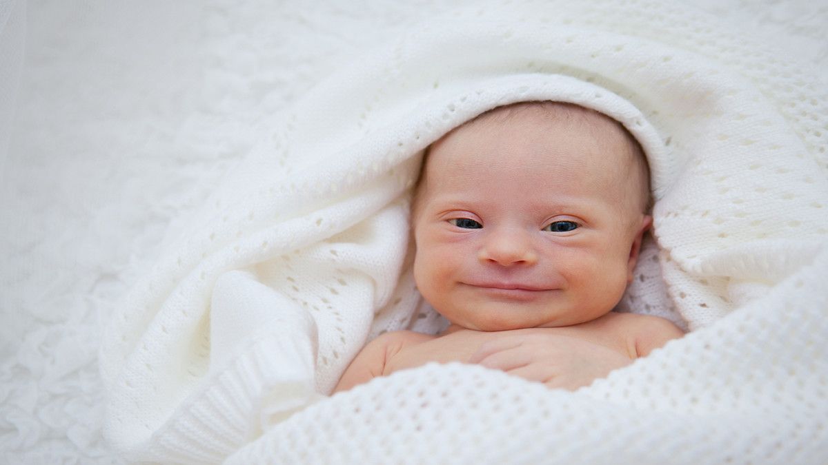 16 Ciri Bayi Down Syndrome yang Harus Dikenali Sejak Dini - KlikDokter