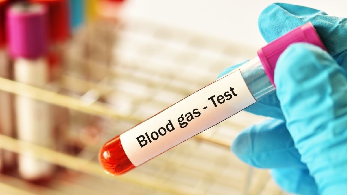 Jenis-Jenis Tes Darah yang Perlu Diketahui - KlikDokter