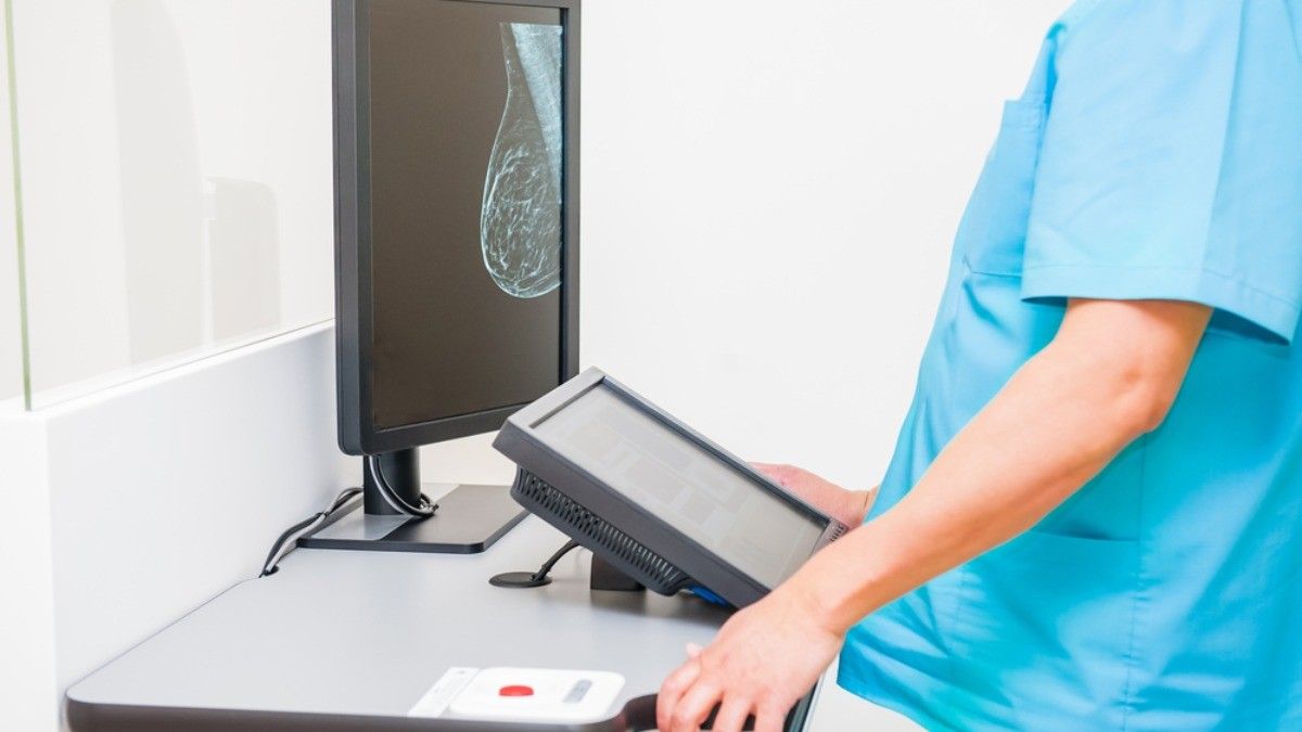 Pemeriksaan Dini Kanker Payudara Bisa dengan SADANIS - KlikDokter