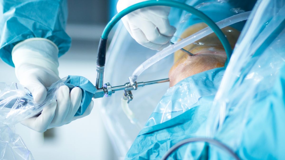 Artroskopi: Tujuan, Prosedur, Efek Samping, hingga Komplikasi - KlikDokter