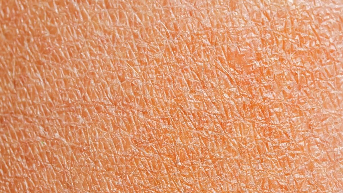 Perbedaan Garis Halus dan Kerutan yang Perlu Anda Tahu - KlikDokter