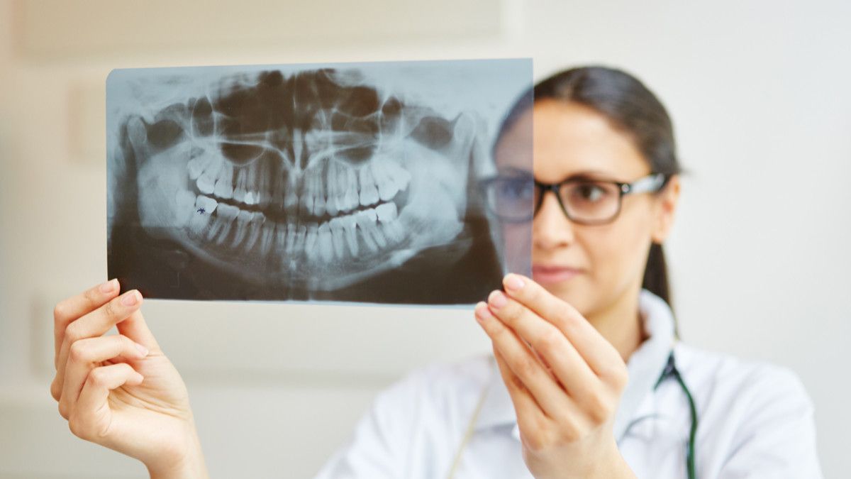 Berapa Jumlah Gigi Orang Dewasa Normal? Ini Jawabannya! - KlikDokter