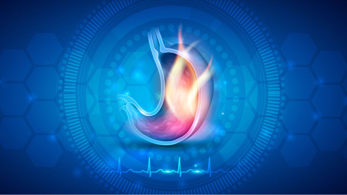 Sering Dikira Sama, Ini Perbedaan GERD dan Maag - KlikDokter