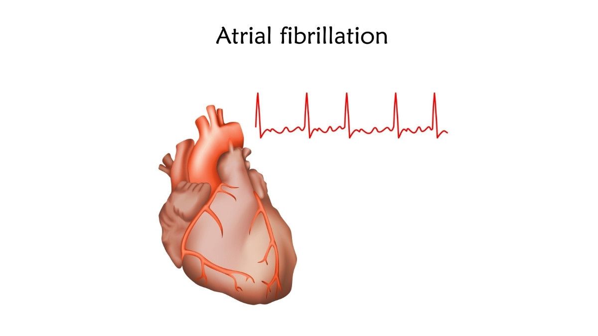 Penyebab Jantung Berdebar dan Sakit Kepala Bersamaan - KlikDokter