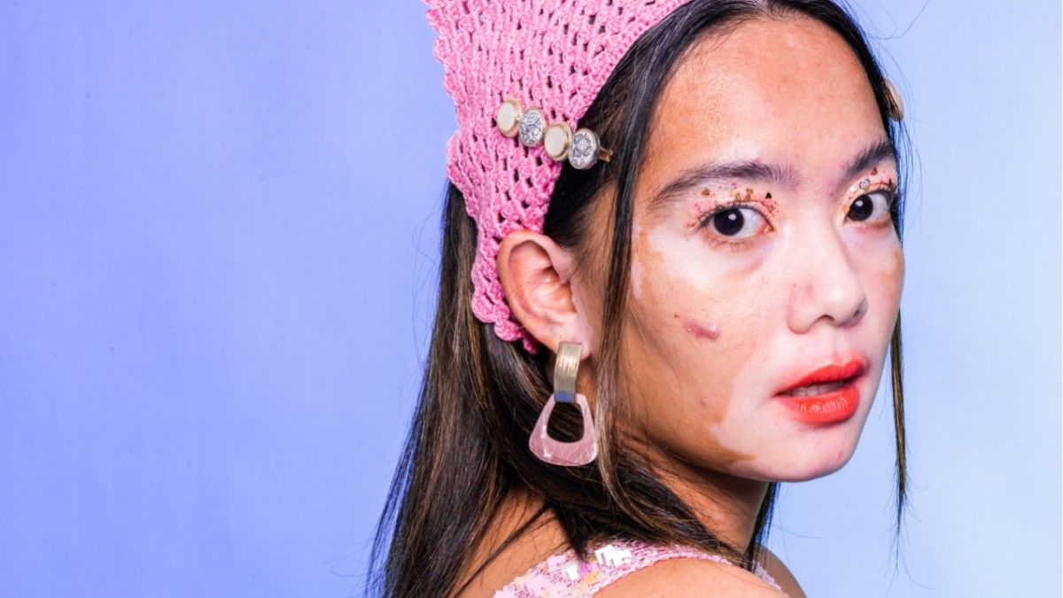 7 Penyebab dan Cara Menghilangkan Bercak Putih di Wajah - KlikDokter