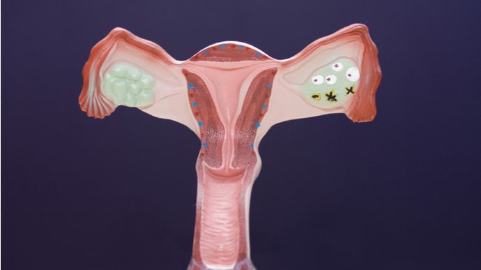 bartholinitis adalah