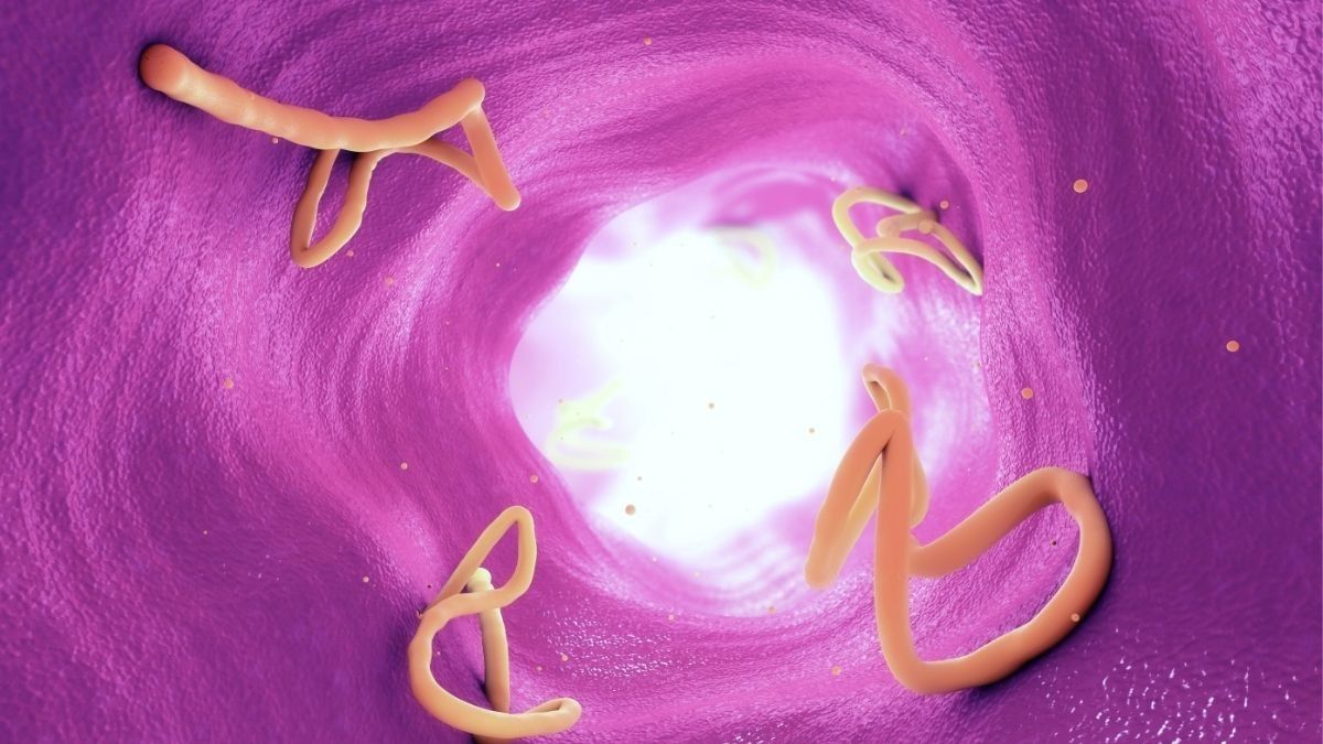 Jangan Aneh-Aneh, Ini Bahaya Diet Cacing Pita - KlikDokter