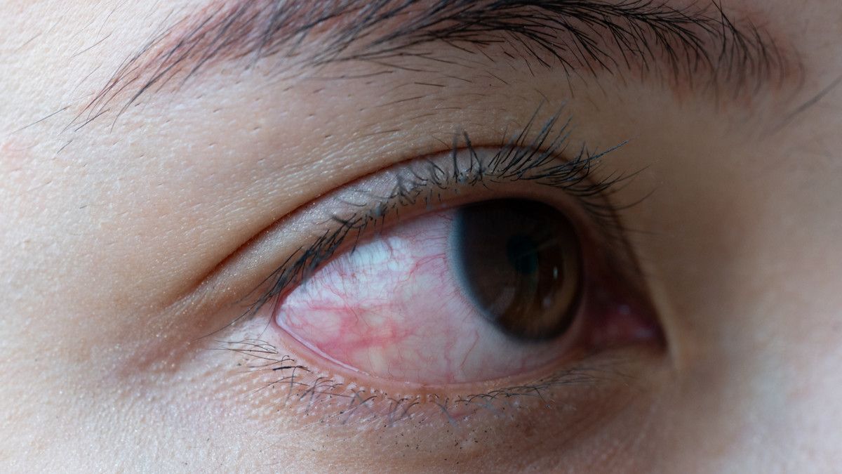 Ablasi Retina, Bisakah Disembuhkan? - KlikDokter