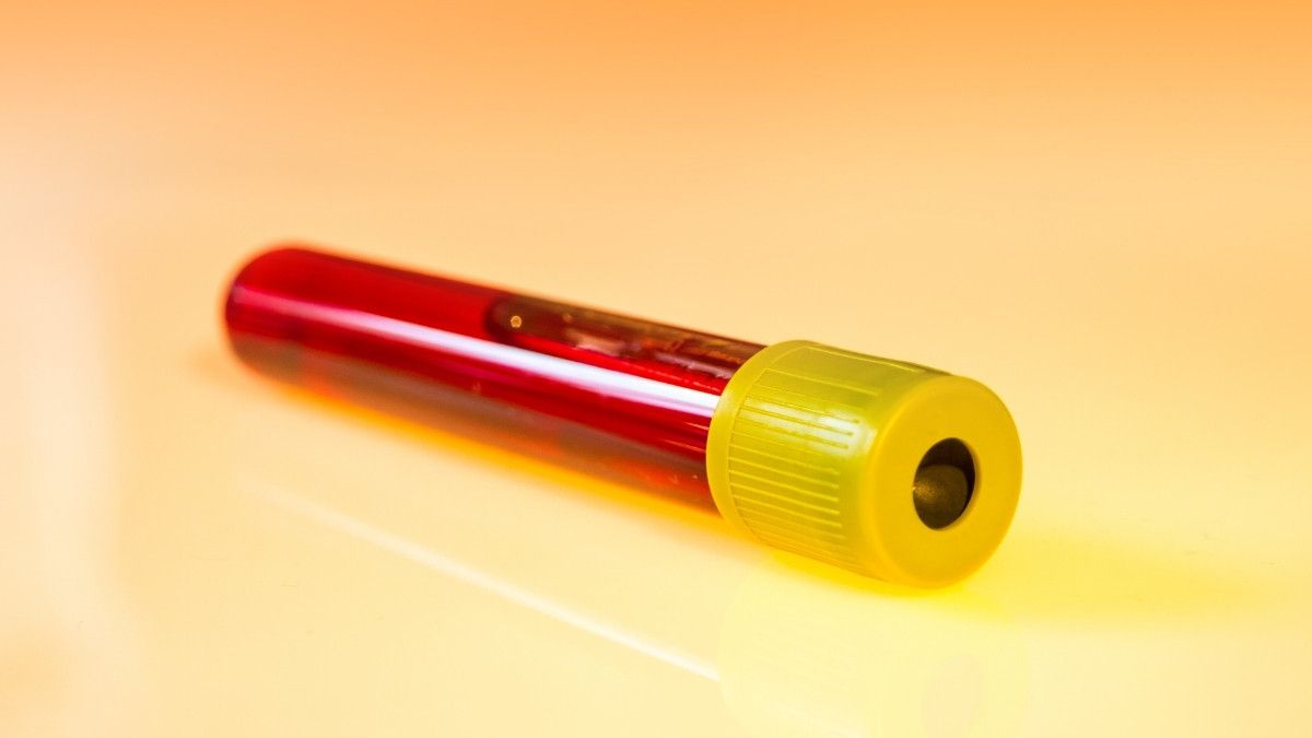 Mengenal IGRA Test, Pemeriksaan Darah untuk Deteksi TBC - KlikDokter