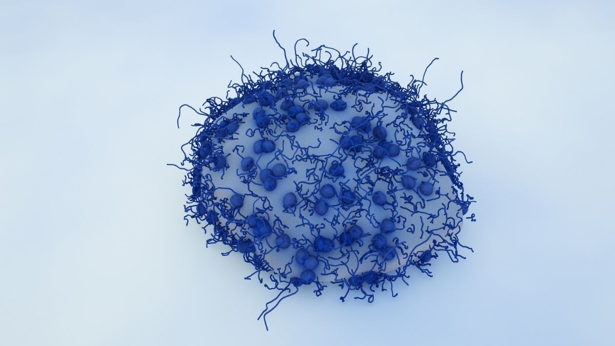 Komplikasi Yang Dapat Terjadi Akibat Kanker Pankreas Klikdokter