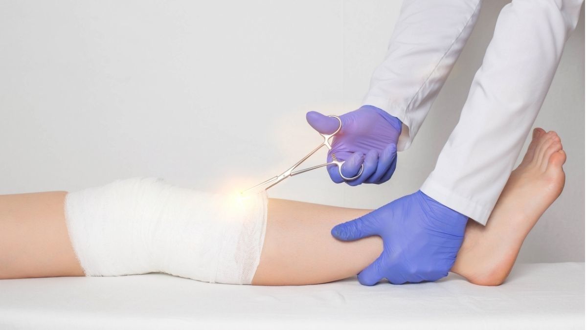 Cedera Tulang Kering, Apa Tanda dan Penanganannya? - KlikDokter