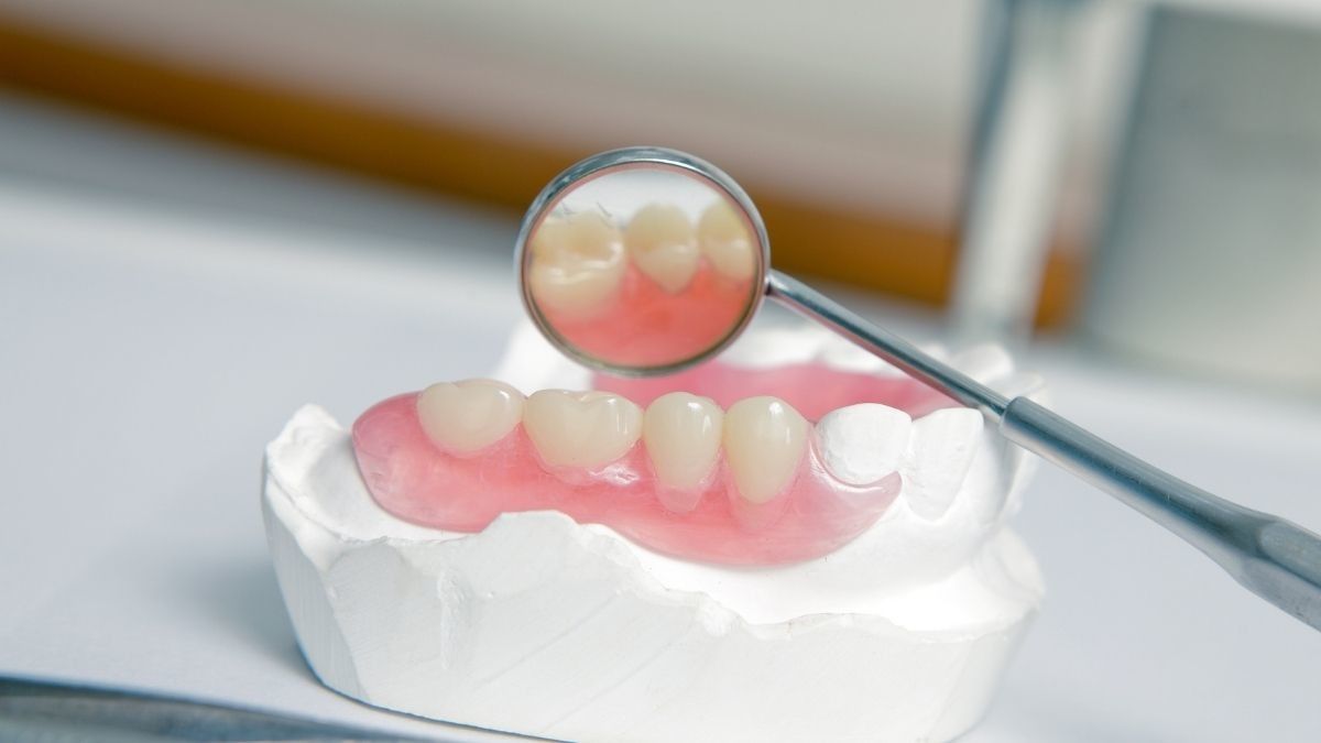 10 Alat Dokter Gigi dan Fungsinya - KlikDokter
