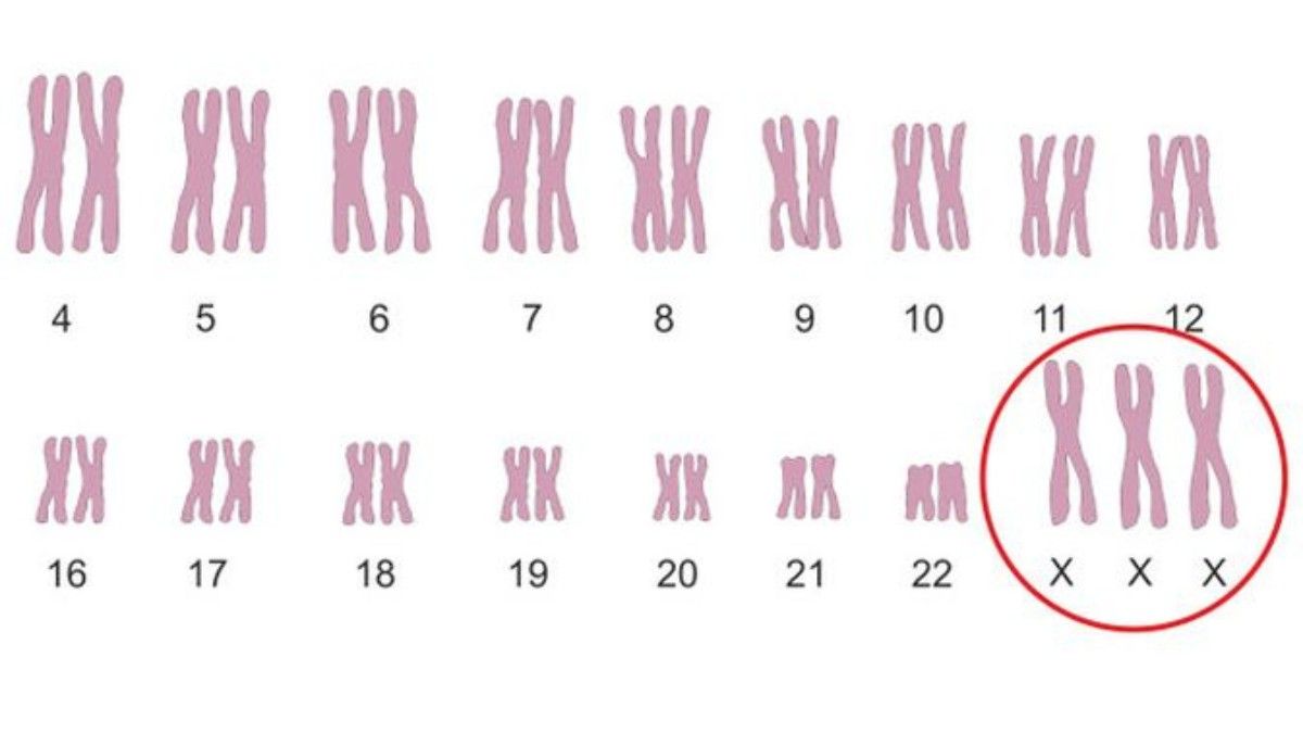 Sindrom Super Female - Penyebab, Gejala, Pengobatan - KlikDokter