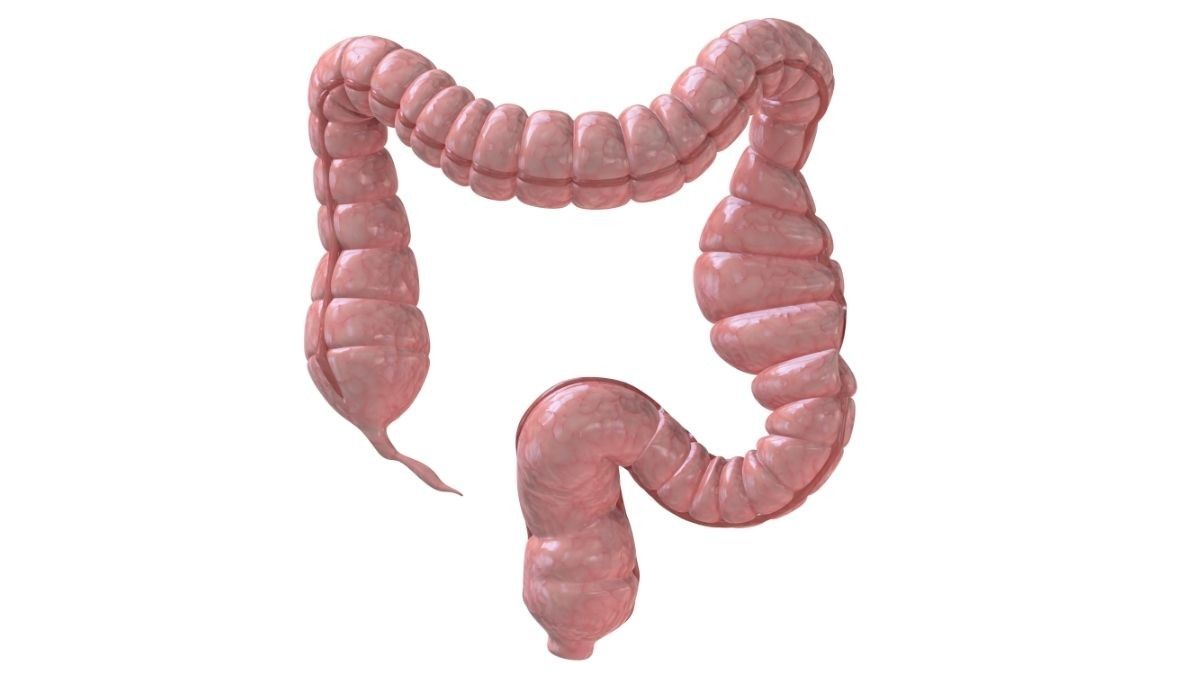 Mengenal Prosedur Ileostomy, Operasi pada Dinding Perut - KlikDokter