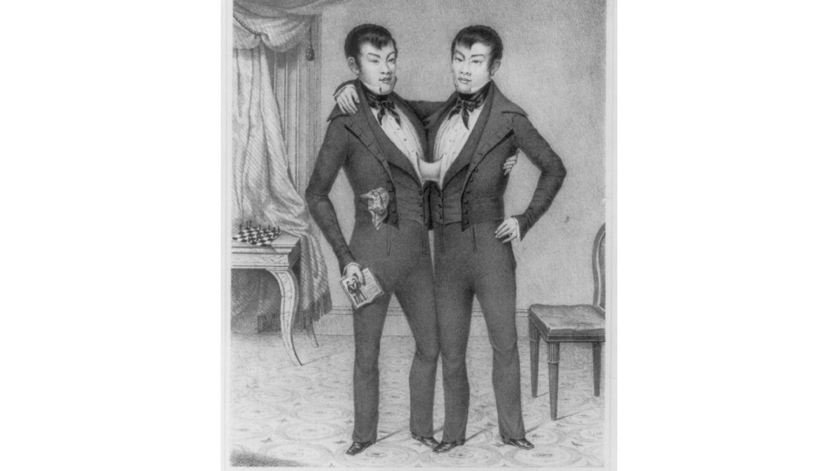 Mengenal Ragam Jenis-Jenis Hamil Kembar Siam - KlikDokter