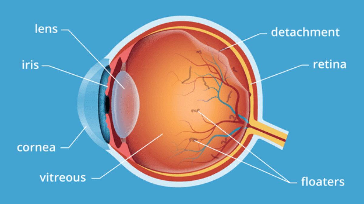 Melihat Bintik-Bintik Melayang? Ini Penyebab Floater di Mata - KlikDokter