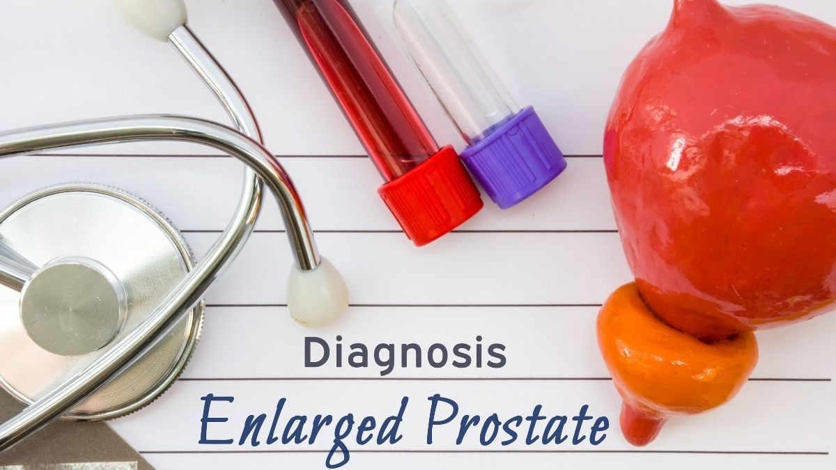 Pembesaran Prostat, Haruskah Dioperasi? Ini Faktanya - KlikDokter