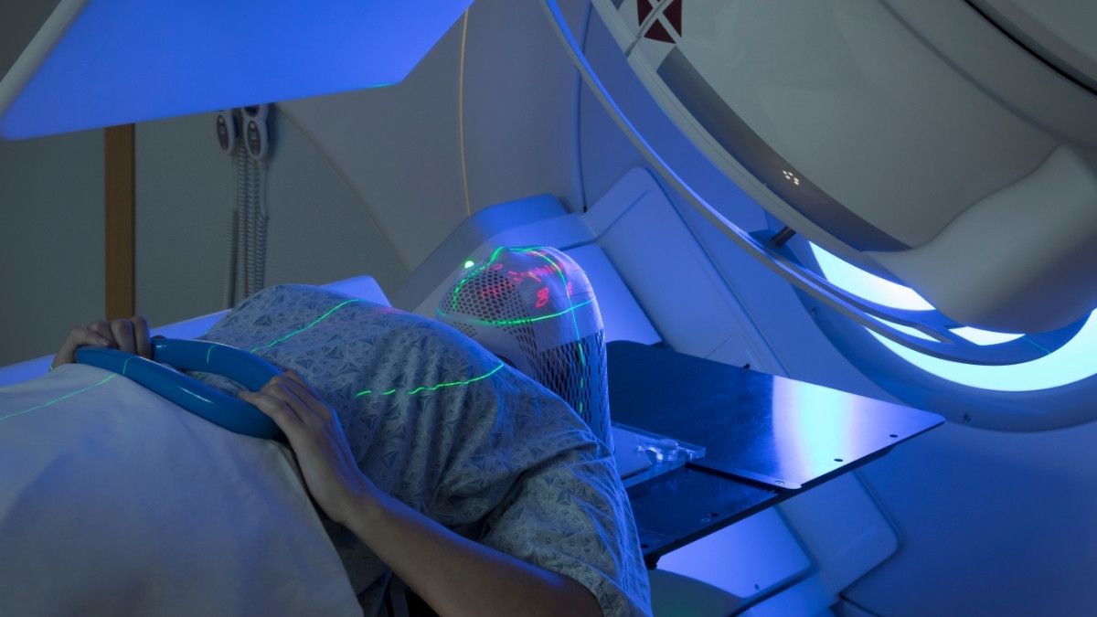 Cara Kemoterapi dan Terapi Radiasi Perlemah Daya Tahan Tubuh - KlikDokter