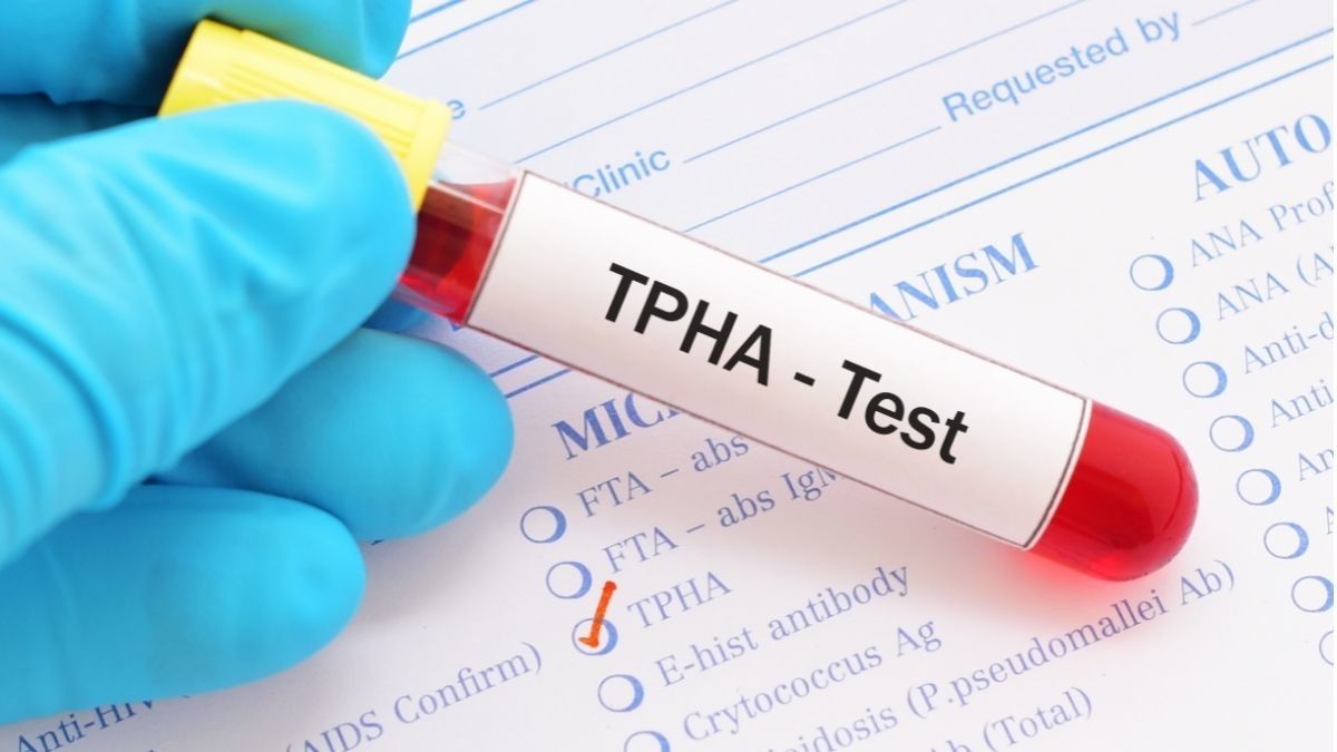 Mengenal Tes TPHA, Skrining Penyakit Sifilis - KlikDokter