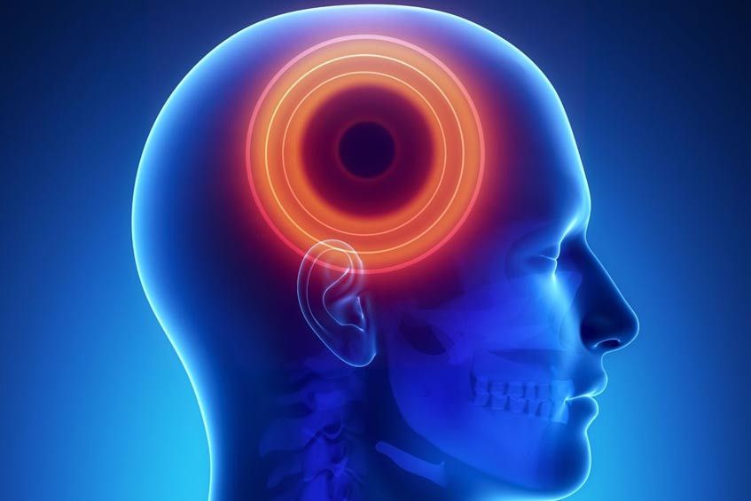 Kenali Jenis Sakit Kepala yang Kerap Menyerang Anda - KlikDokter