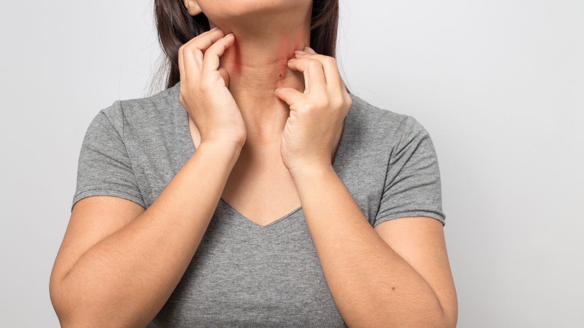 Methylprednisolone - Manfaat, Dosis, dan Efek Samping - KlikDokter